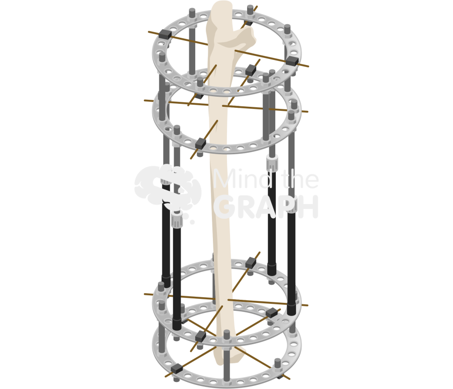 Ilizarov fixator equipment