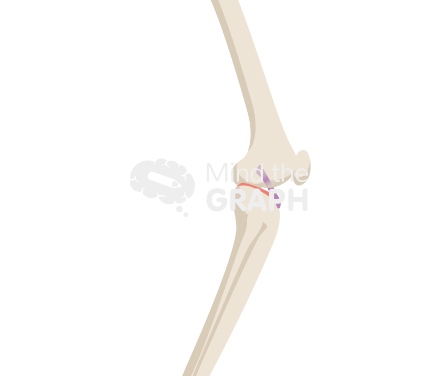 Free Anterior cruciate ligament wear knee bone full Icons, Symbols ...