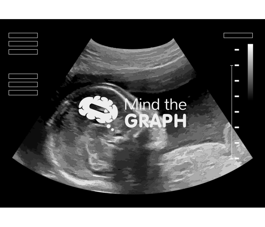 Free Biophysical profile bpp ultrasound Icons, Symbols, Pictures, and ...