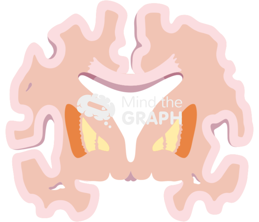 Free Brain cut alzheimer mild disease Icons, Symbols, Pictures, and ...
