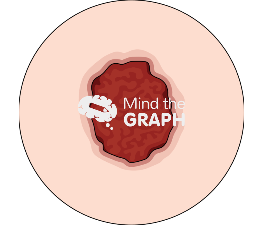 Free Carcinoma zoom Icons, Symbols, Pictures, and Images | Mind the Graph