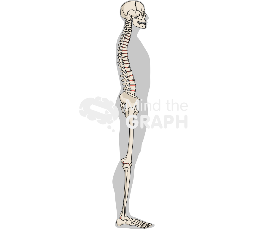 Column sagittally balanced lateral