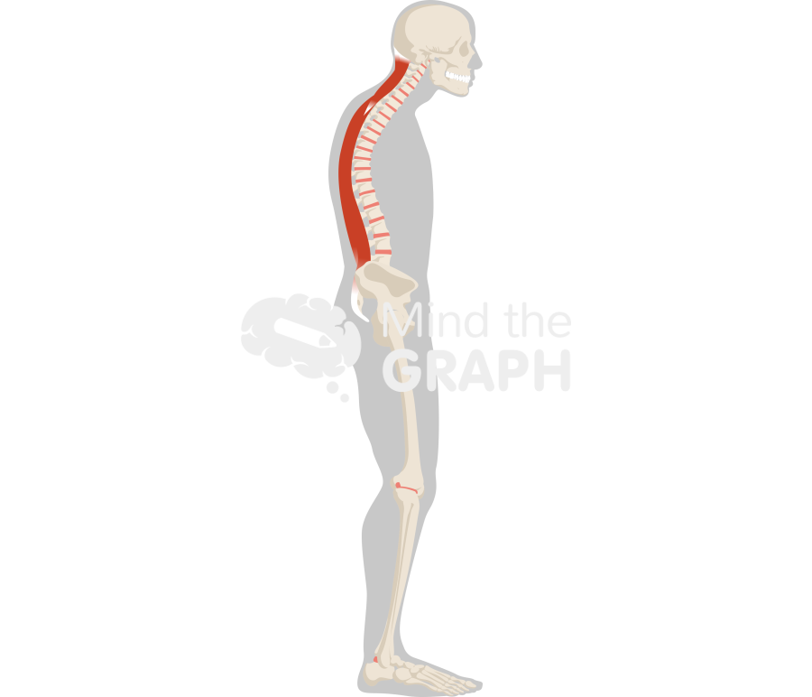 Free Column sagittally balanced muscle compensation erector spinae ...