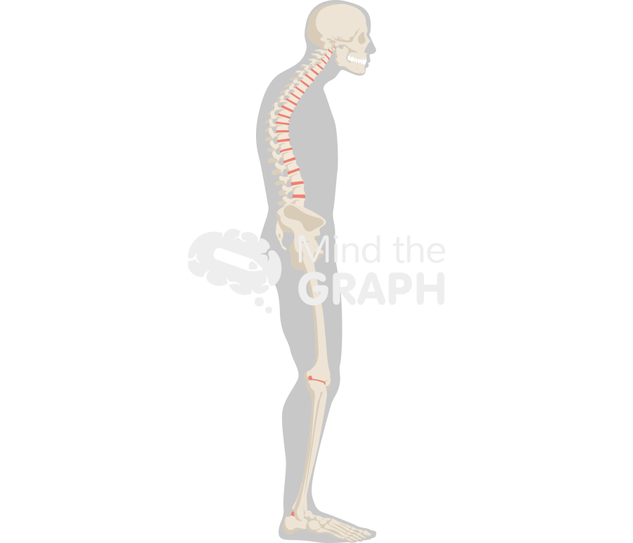 Free Column sagittally balanced muscle compensation lateral Icons ...