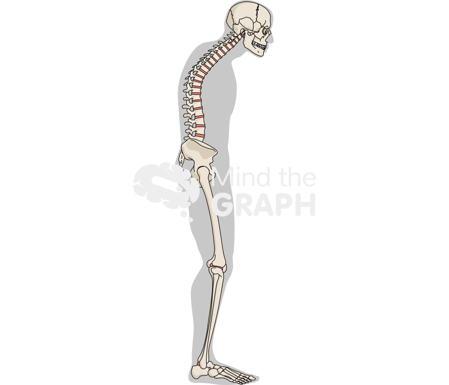 Free Column sagittally imbalanced lateral Icons, Symbols, Pictures, and ...