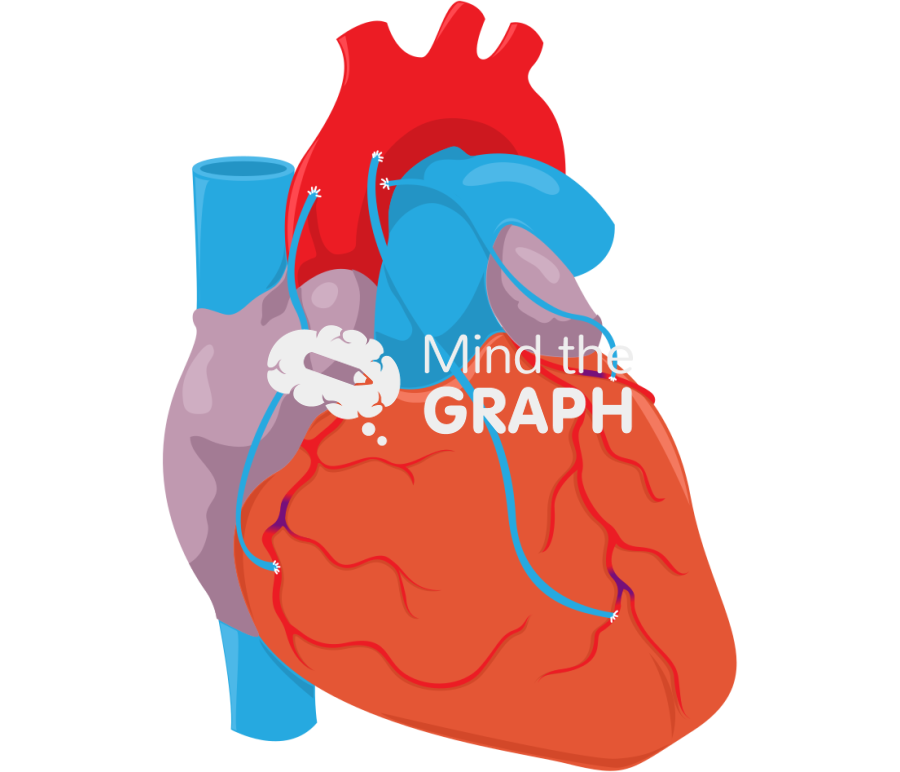 Free Coronary artery bypass grafting 6 Icons, Symbols, Pictures, and ...
