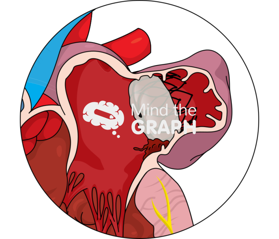 Free Device related thrombus drt zoom Icons, Symbols, Pictures, and ...