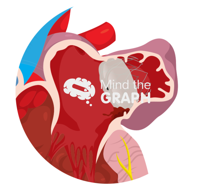 Free Device related thrombus drt zoom Icons, Symbols, Pictures, and ...