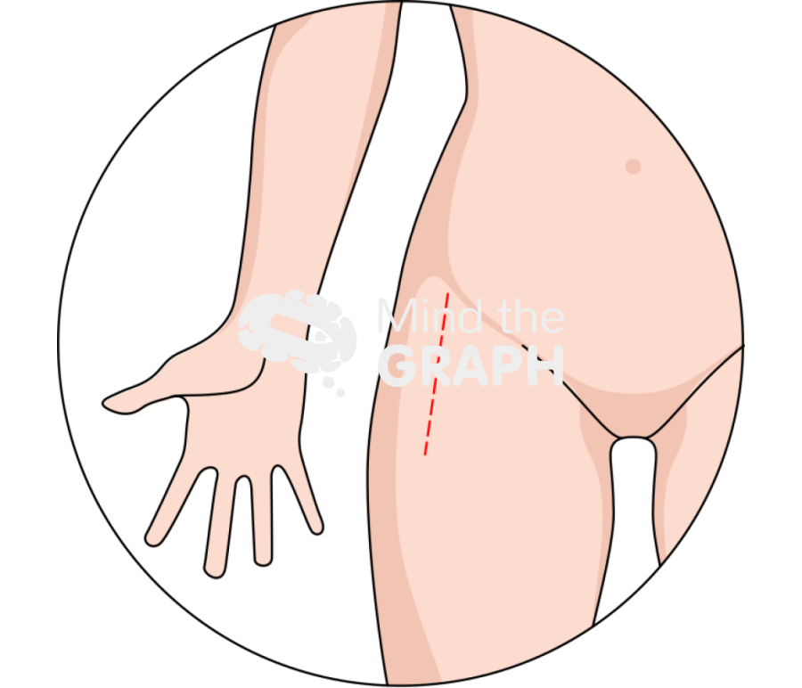 Direct anterior approach daa incision body zoom Direct anterior approach daa incision body zoom