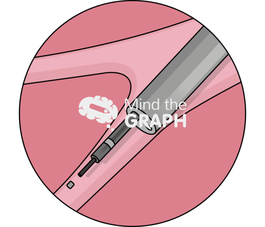 Free Enb guided rfid marking lung zoom Icons, Symbols, Pictures, and ...