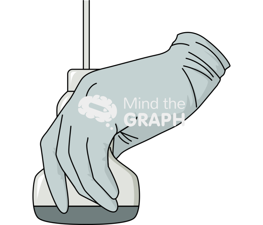 Hand ultrasound 2 lateral