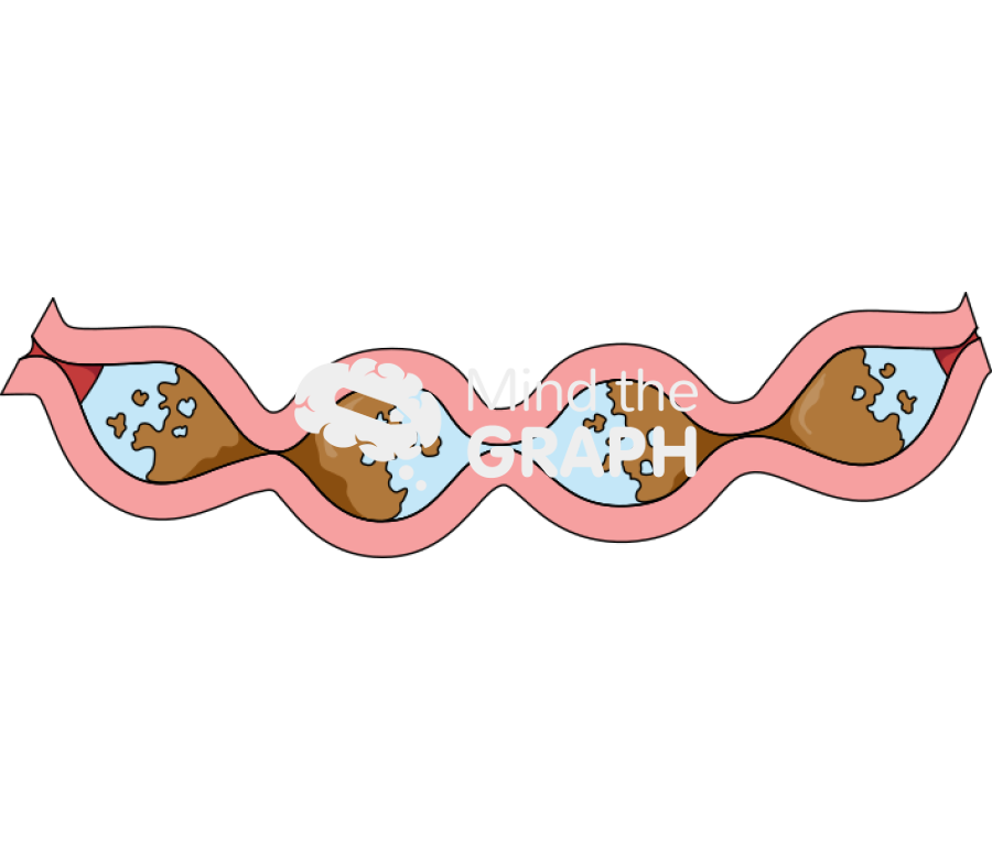 Intestine segmentation 2