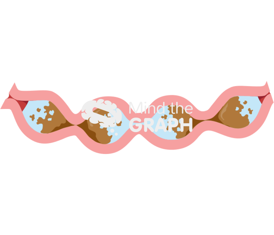 Intestine segmentation 2