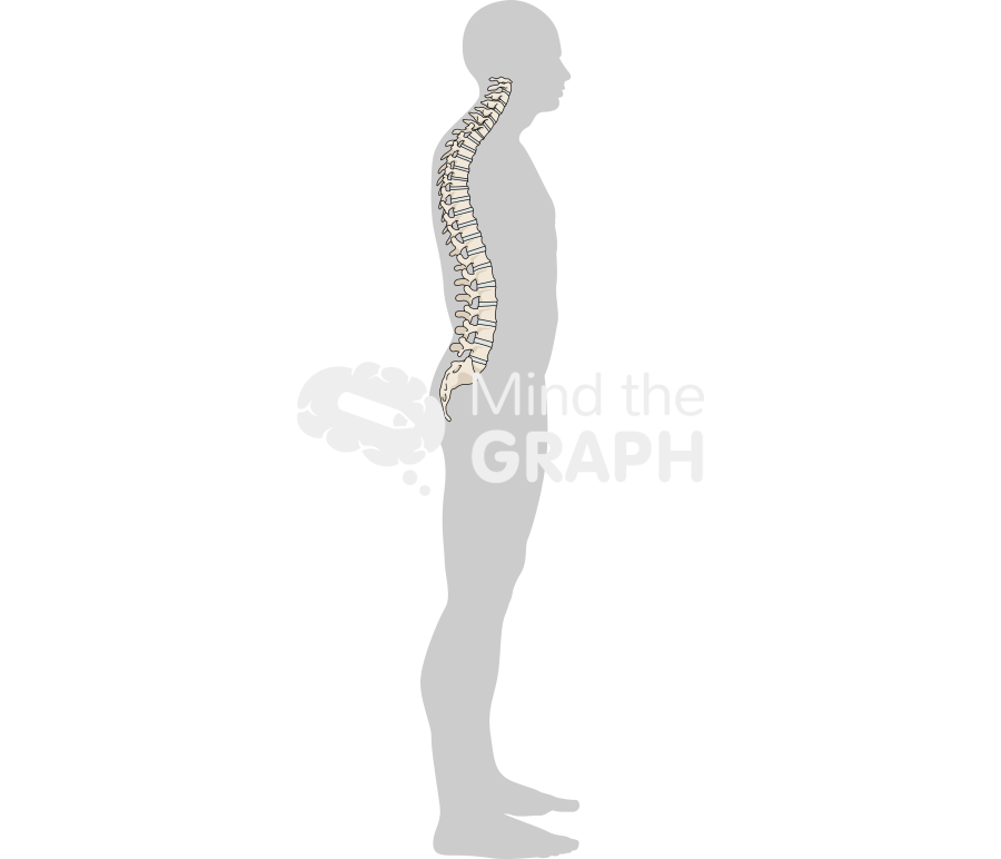 Man column kyphosis lateral body