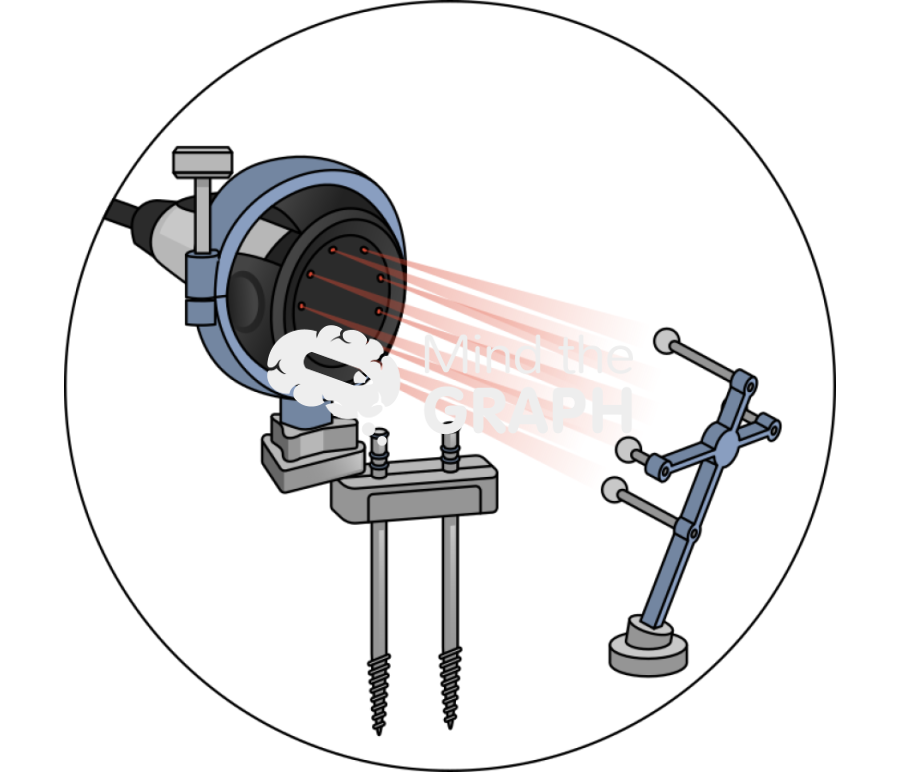 Free Navigation total knee arthroplasty zoom Icons, Symbols, Pictures ...