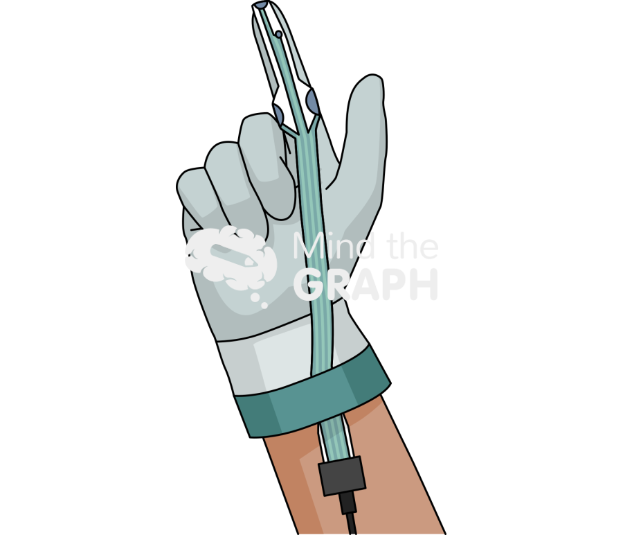 Free Nicolet st marks pudendal ncs electrode Icons, Symbols, Pictures ...