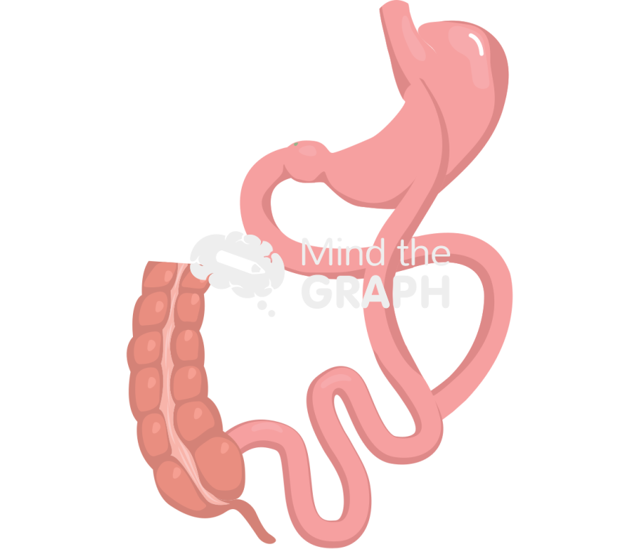 Free Nissen bypass 2 Icons, Symbols, Pictures, and Images | Mind the Graph