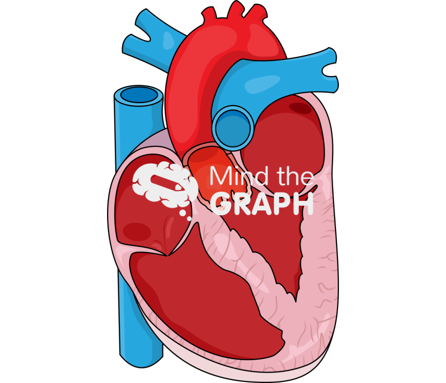 Paradoxical low flow low gradient severe aortic stenosis 2