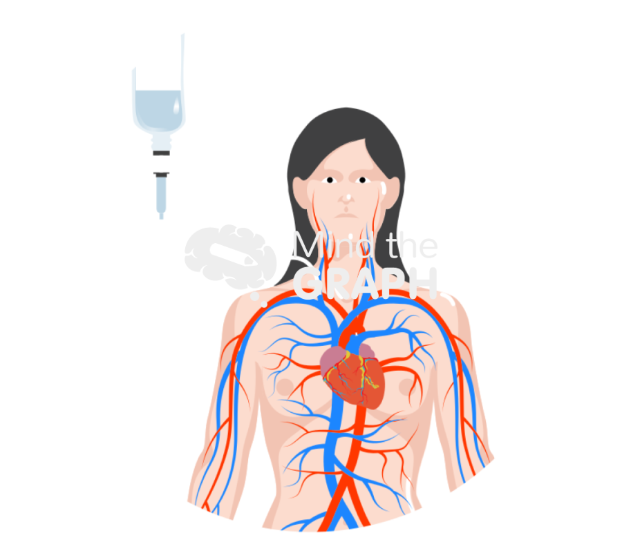 Free Parenteral nutrition superior vena cava Icons, Symbols, Pictures ...