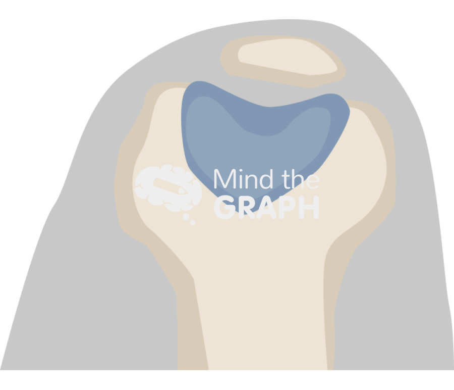 Patellofemoral joint knee sunrise onlay