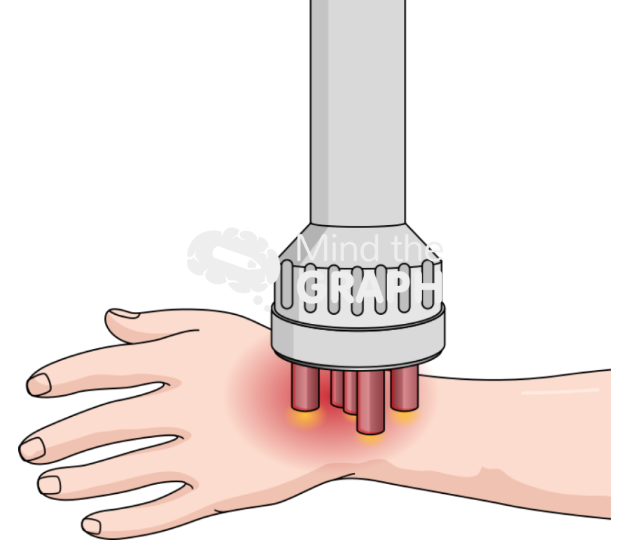 Photobiomodulation therapy