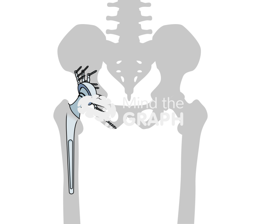 how to draw hip joint