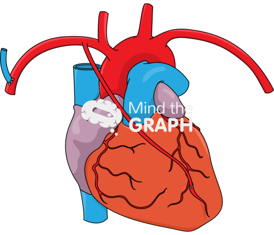 Free Right internal mammary artery ipsilateral arteriovenous fistula ...