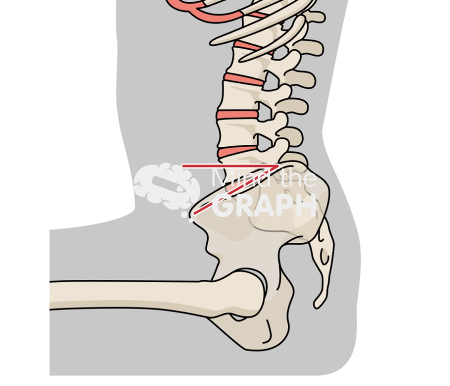 Sacral slope sitting