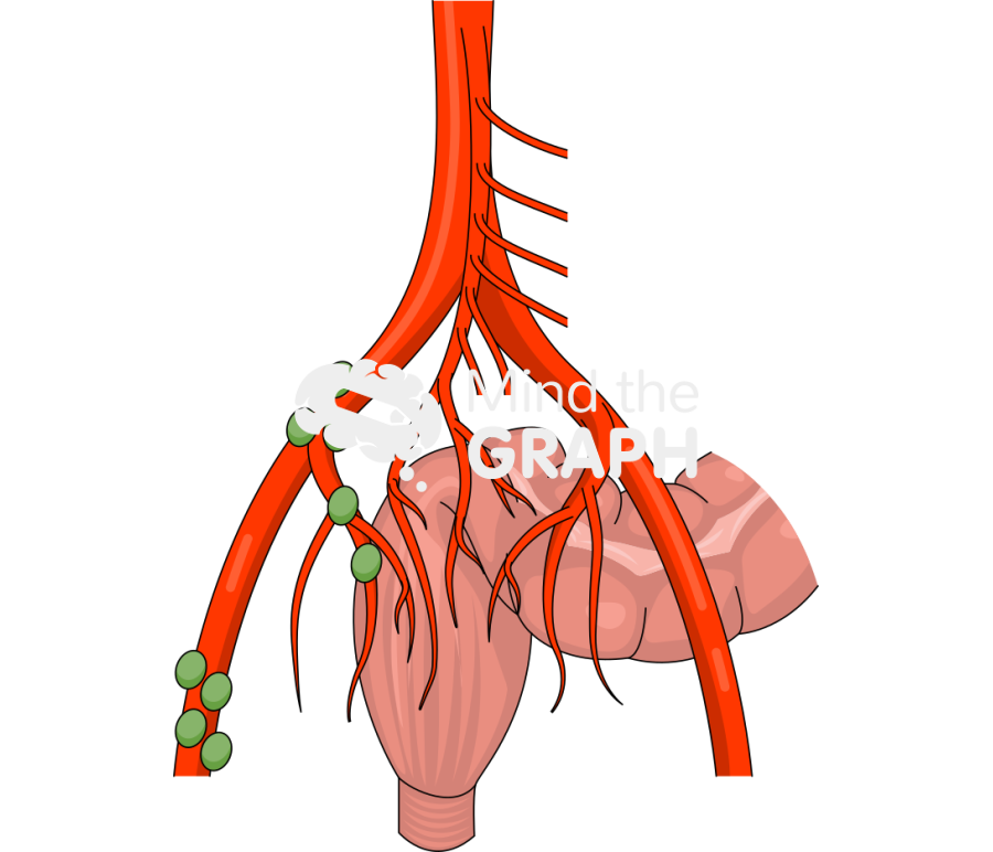 Free Schematic representation pelvic left lymph node Icons, Symbols ...