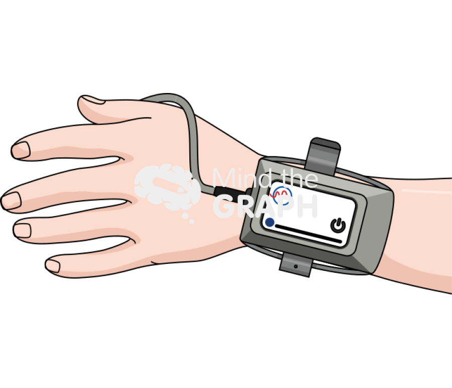 Skin conductance algesimeter pain sensor hand