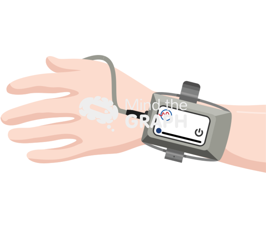 Skin conductance algesimeter pain sensor hand
