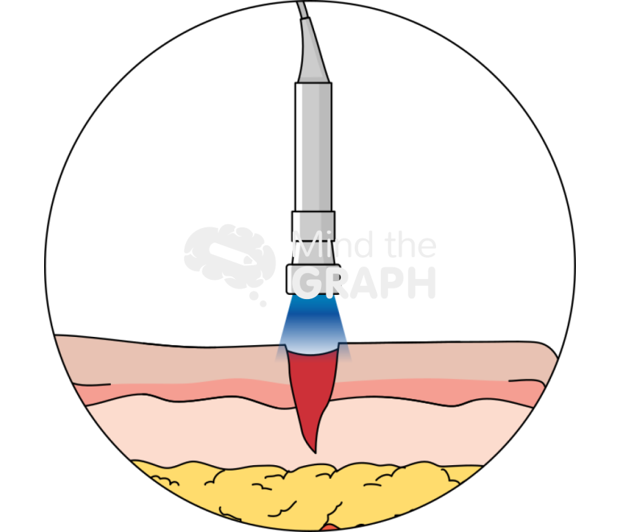 Skin injury light treatment zoom