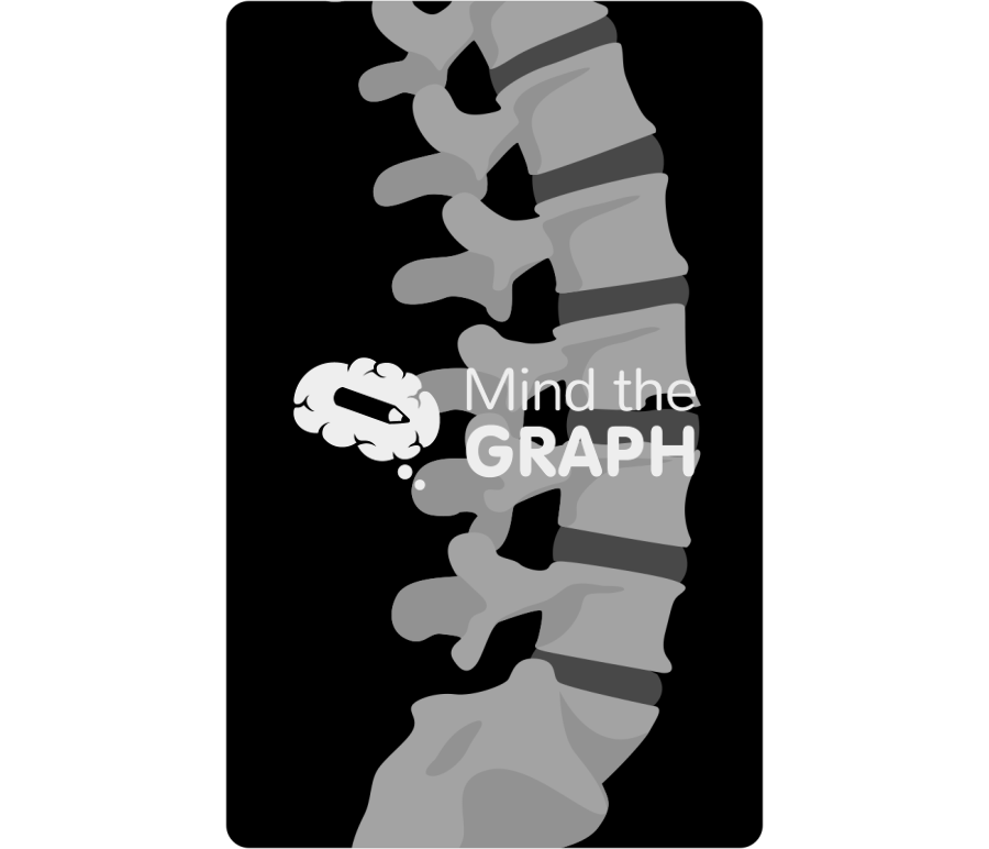 Free Spondylodiscitis ct scan l3 l4 disc Icons, Symbols, Pictures, and ...