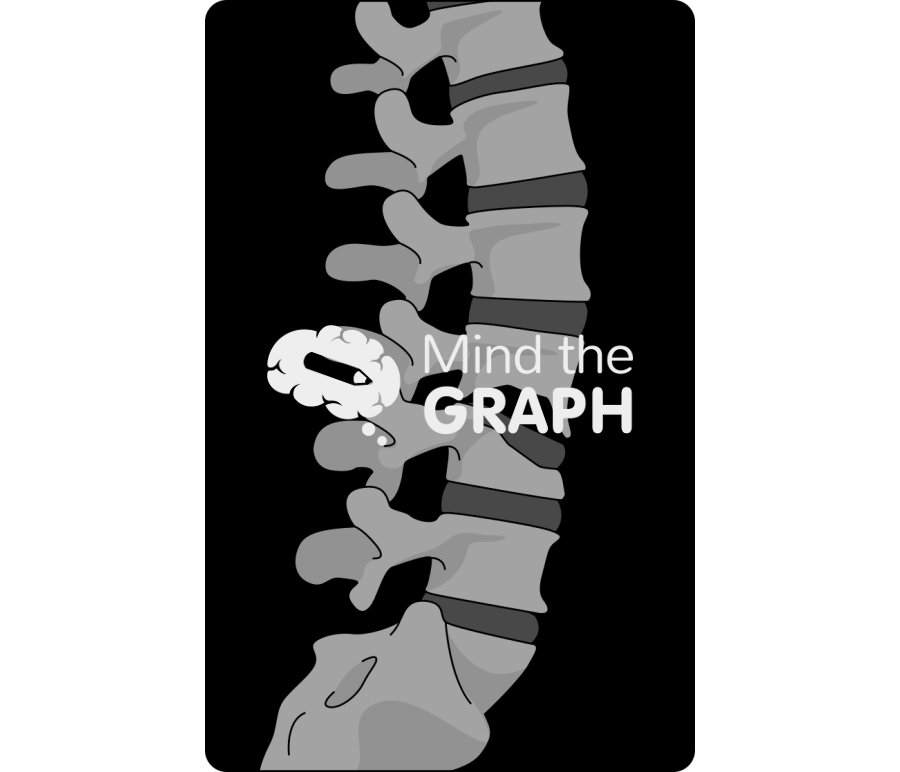 Free Spondylodiscitis progress ct scan l3 l4 disc Icons, Symbols ...