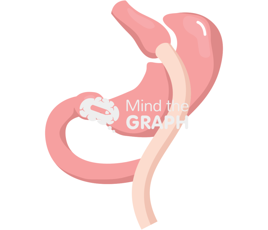 Free Stomach gastric bypass 2 Icons, Symbols, Pictures, and Images ...