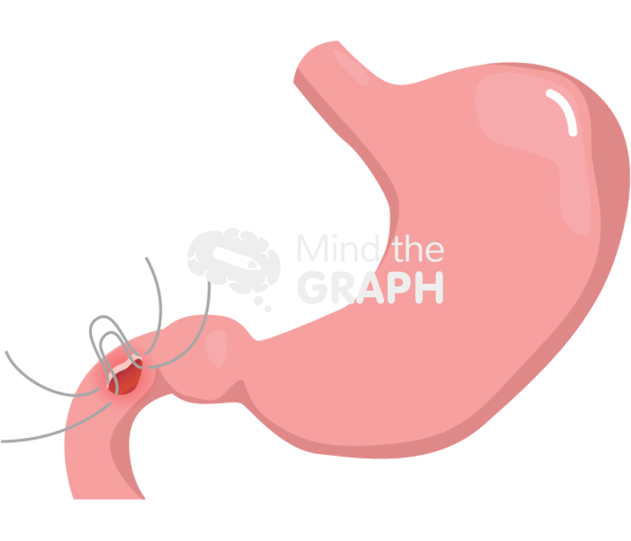 Stomach graham patch 1