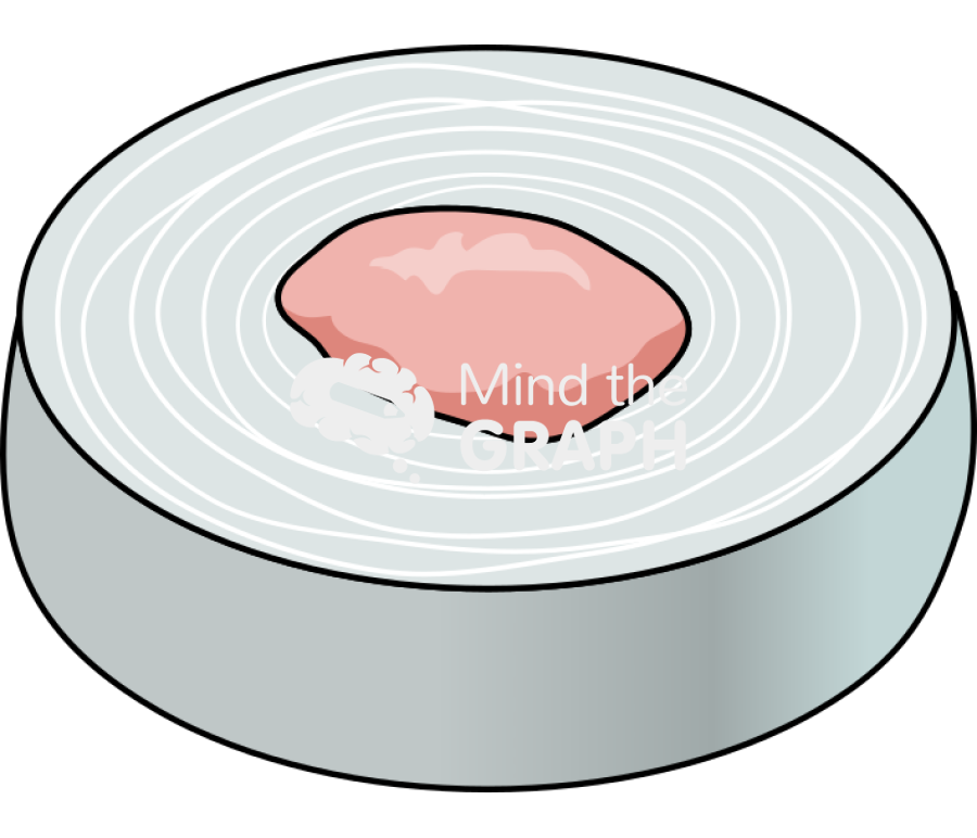Vertebral disc normal